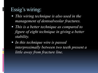 Various intermaxillary fixation techniques | PPTX