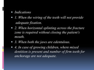 Various intermaxillary fixation techniques | PPTX