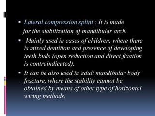 Various intermaxillary fixation techniques | PPTX