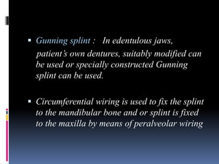 Various intermaxillary fixation techniques | PPTX