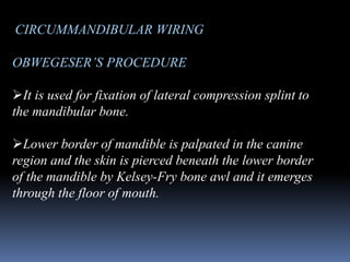 Various intermaxillary fixation techniques | PPTX
