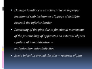Various intermaxillary fixation techniques | PPTX