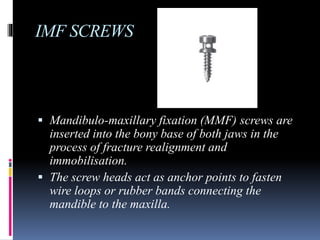 Various intermaxillary fixation techniques | PPTX