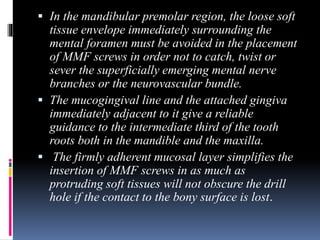 Various intermaxillary fixation techniques | PPTX