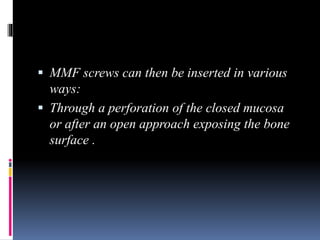 Various intermaxillary fixation techniques | PPTX