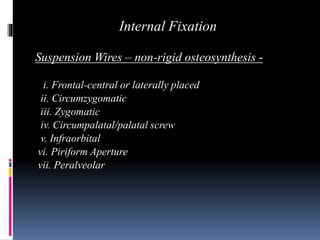 Various intermaxillary fixation techniques | PPTX