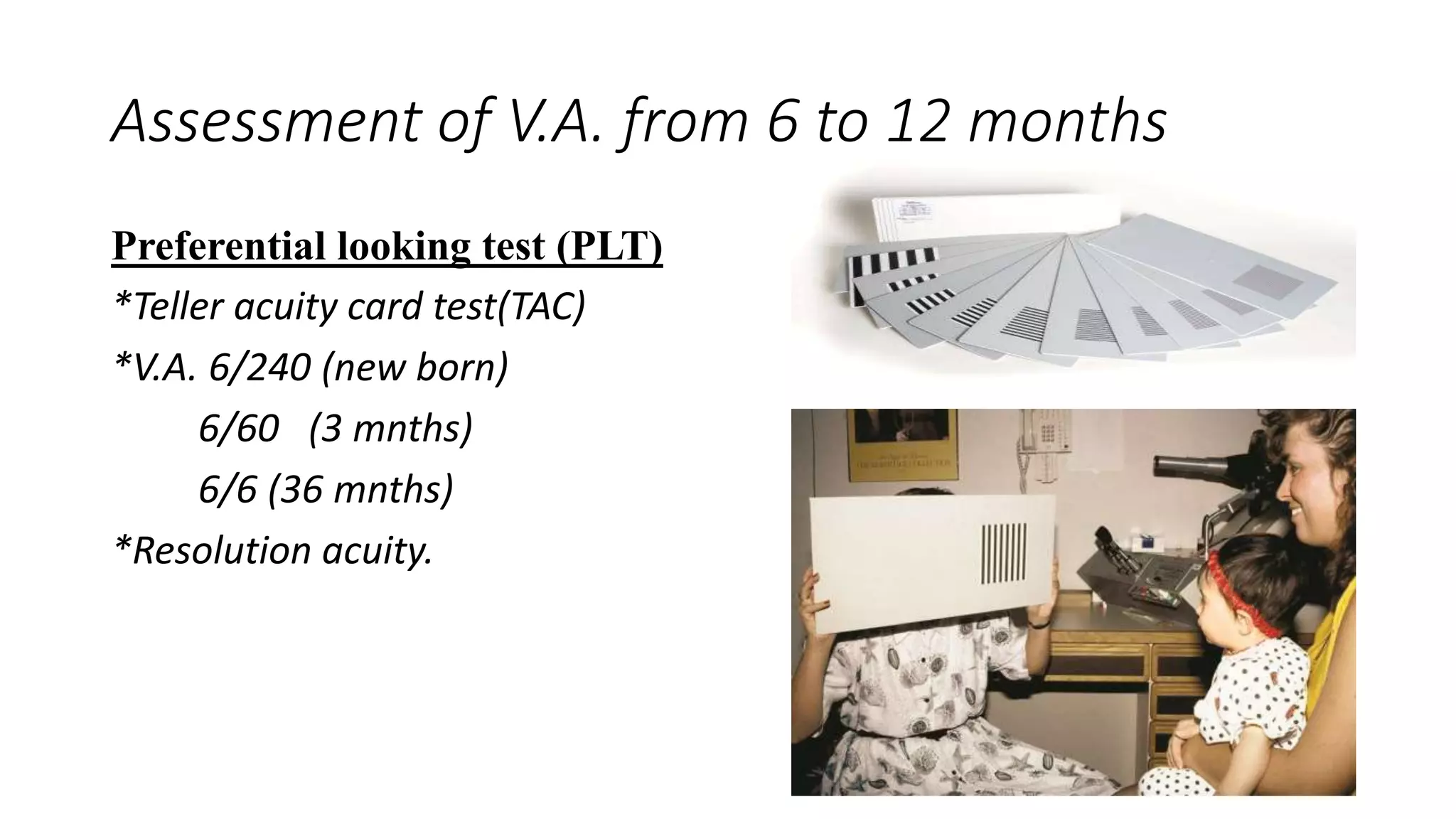Various methods of measurement of visual acuity in children | PPTX