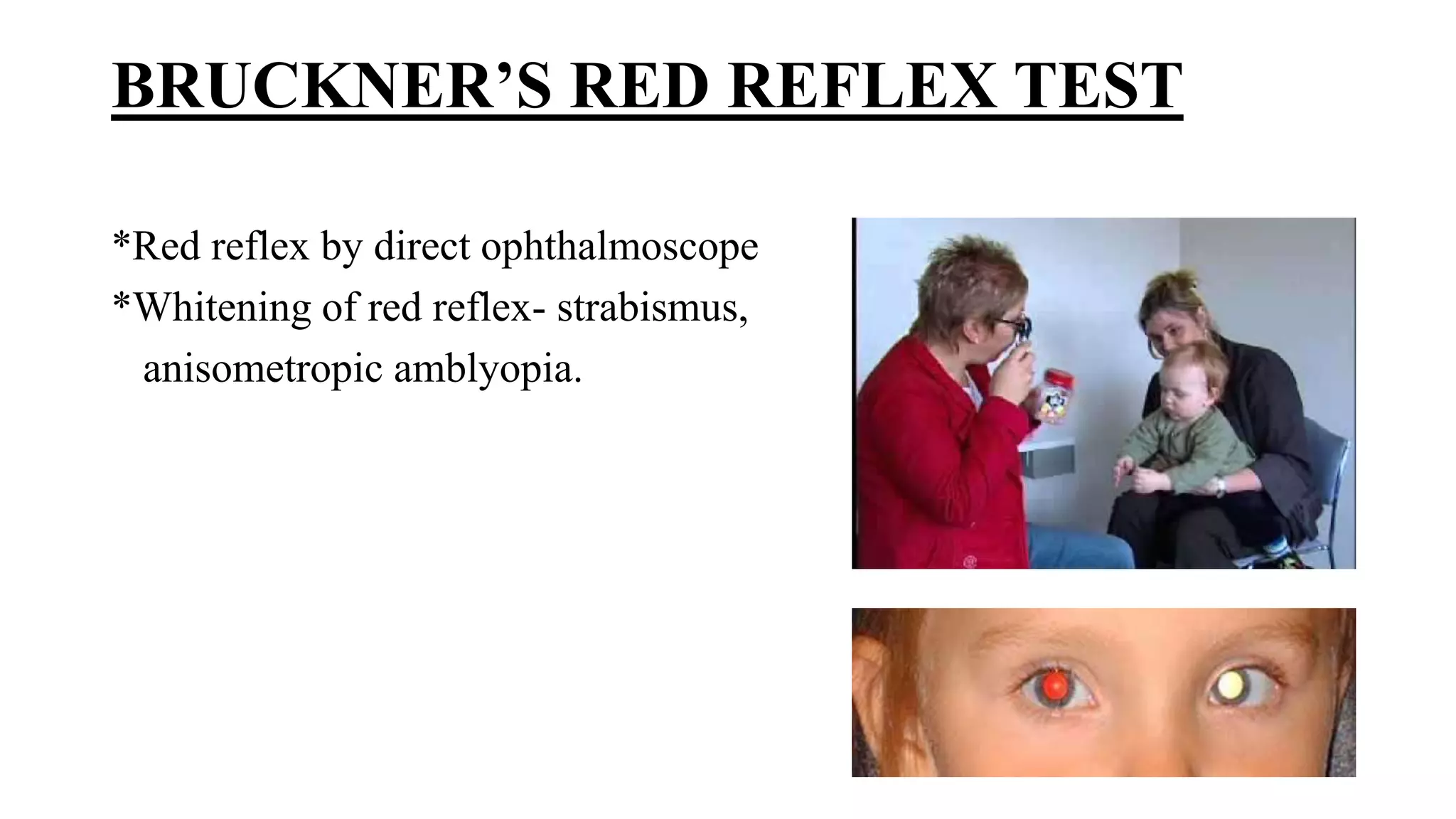 Various methods of measurement of visual acuity in children | PPTX