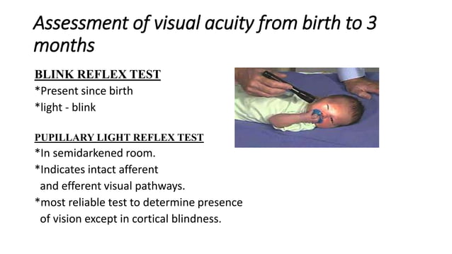 Various methods of measurement of visual acuity in children | PPTX