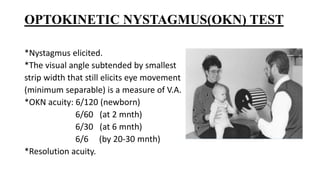 Various methods of measurement of visual acuity in children | PPTX