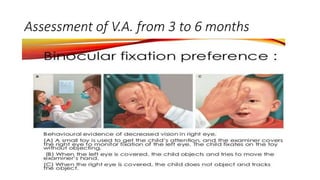 Various methods of measurement of visual acuity in children | PPTX