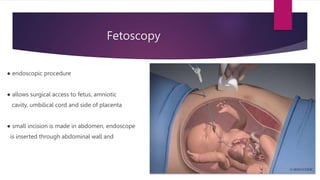 Various methods of prenatal diagnosis.pptx