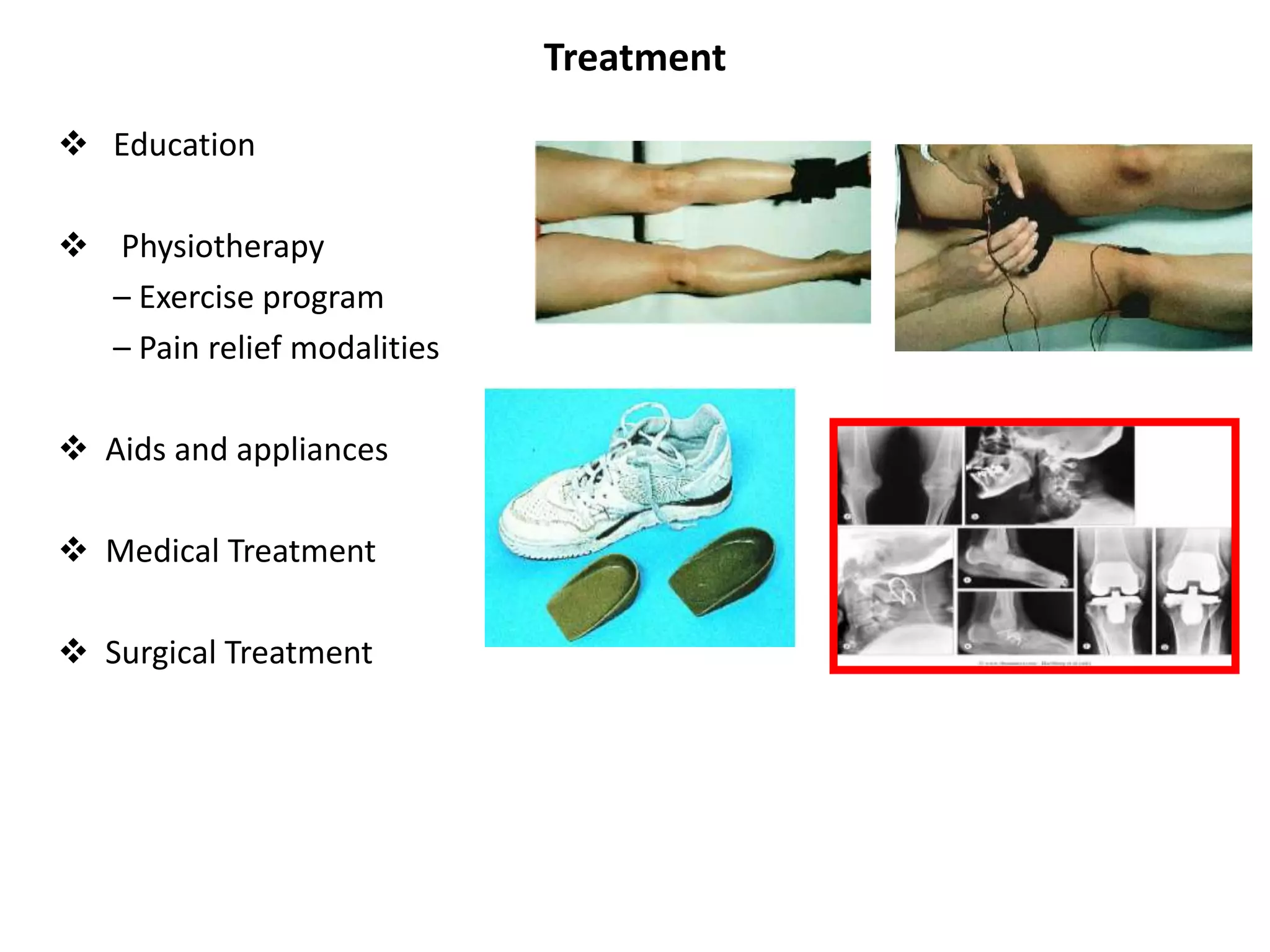 Various rheumatological diseases | PPTX