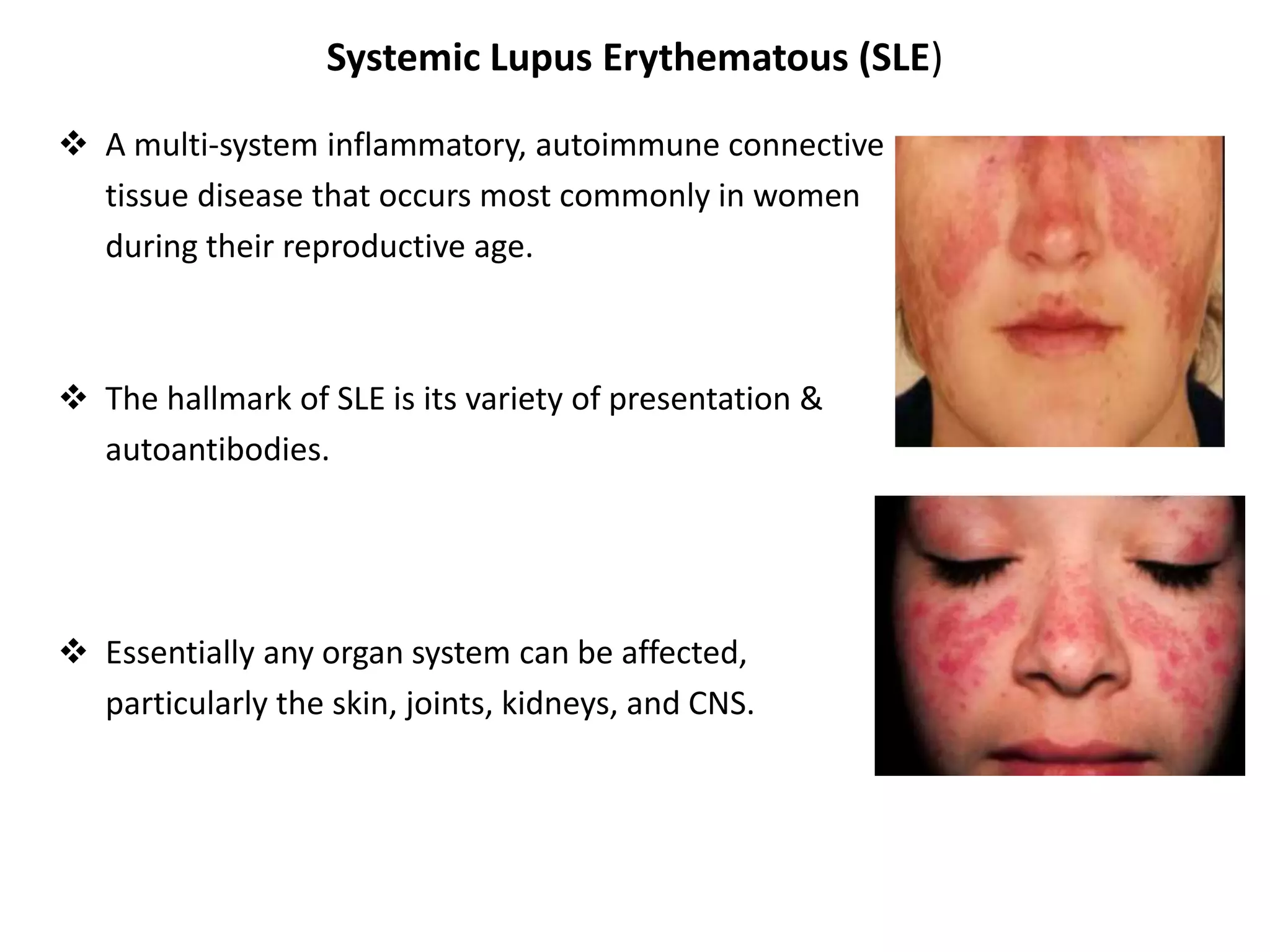 Various rheumatological diseases | PPTX