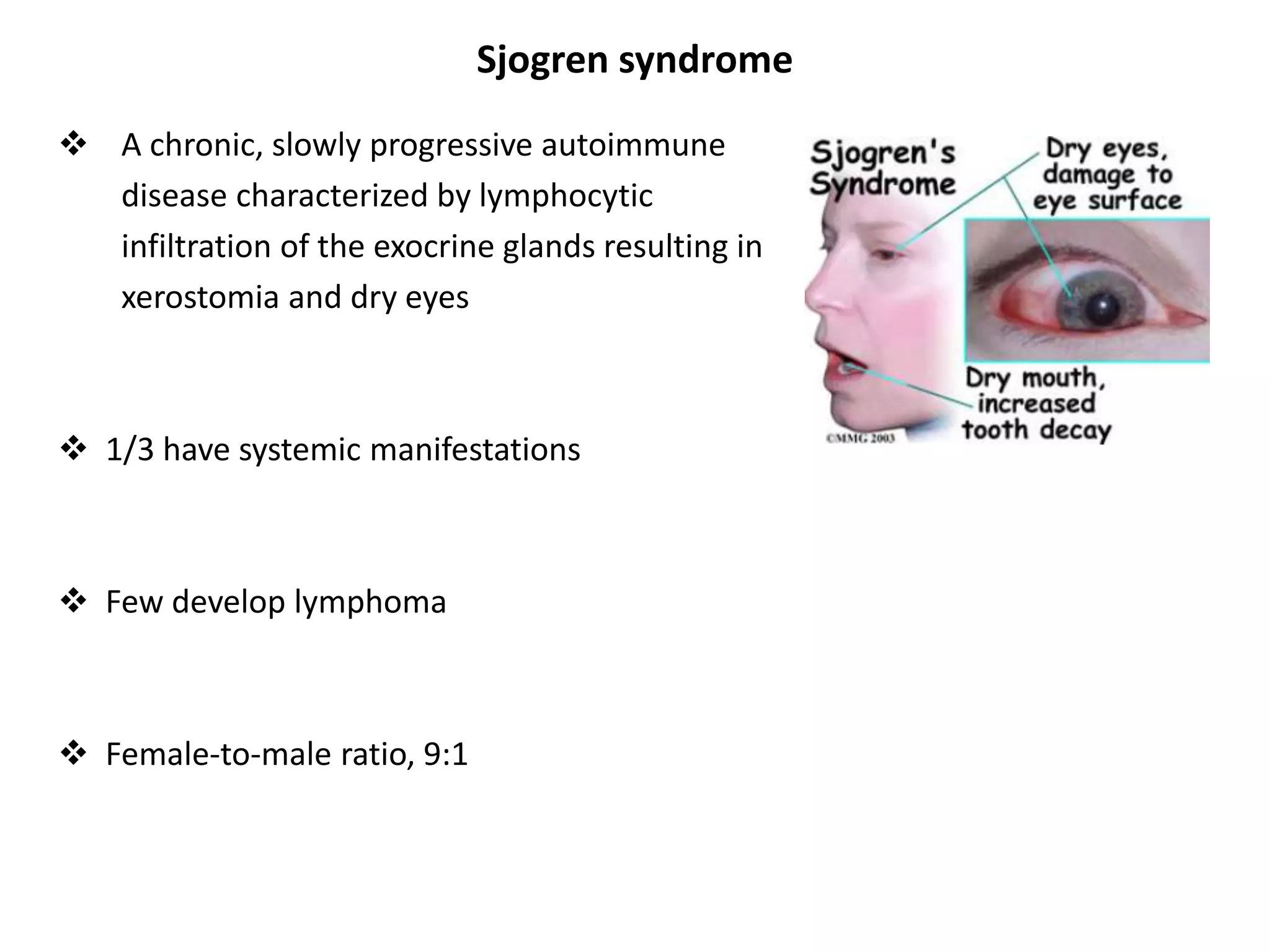 Various rheumatological diseases | PPTX