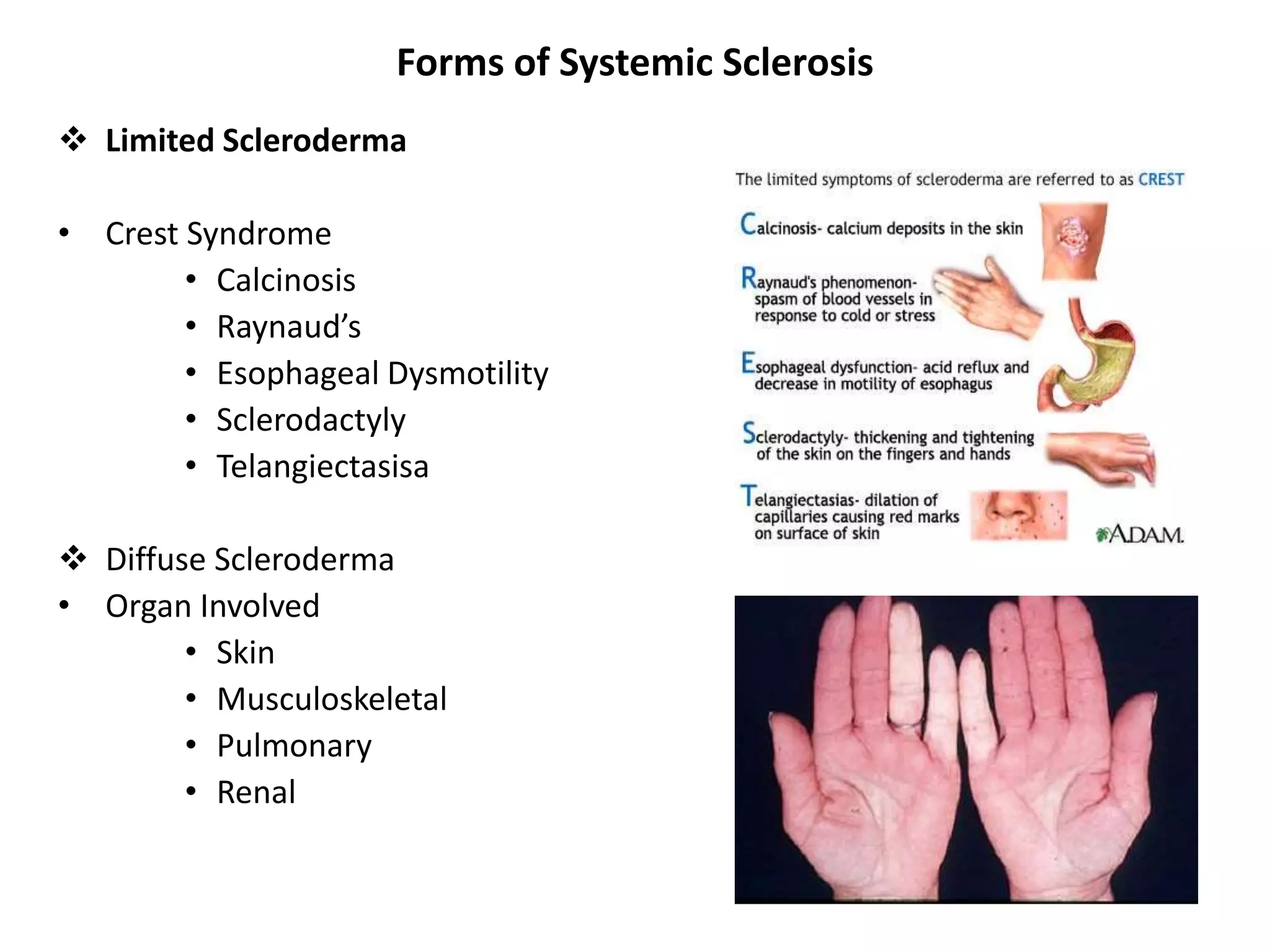 Various rheumatological diseases | PPTX