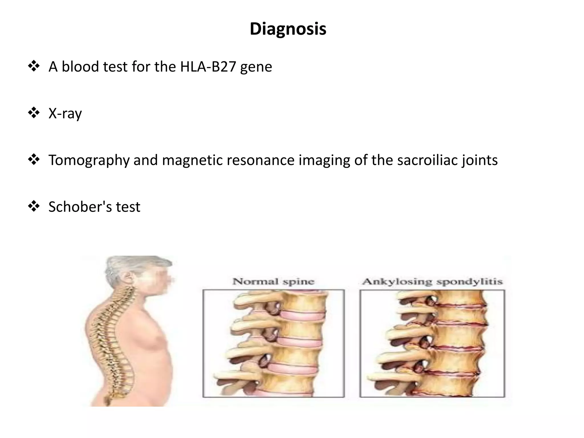 Various rheumatological diseases | PPTX