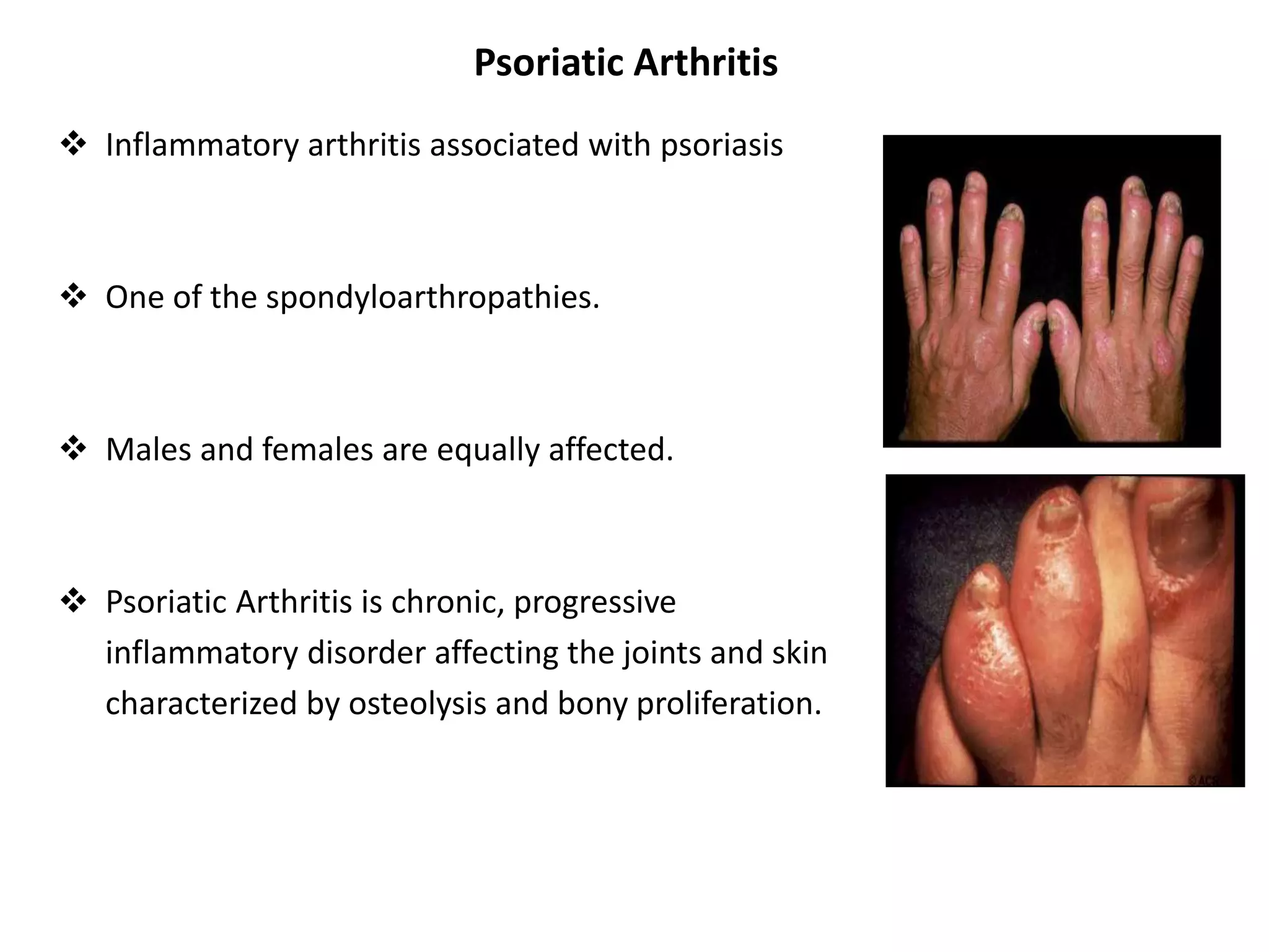 Various rheumatological diseases | PPTX