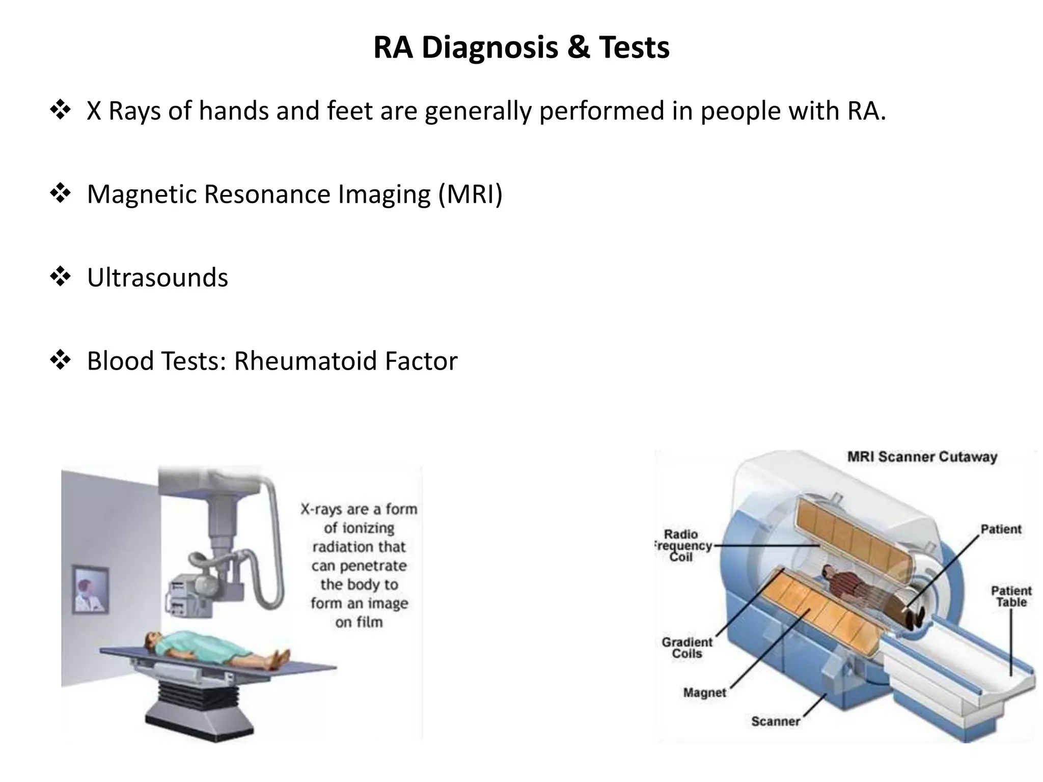 Various rheumatological diseases | PPTX