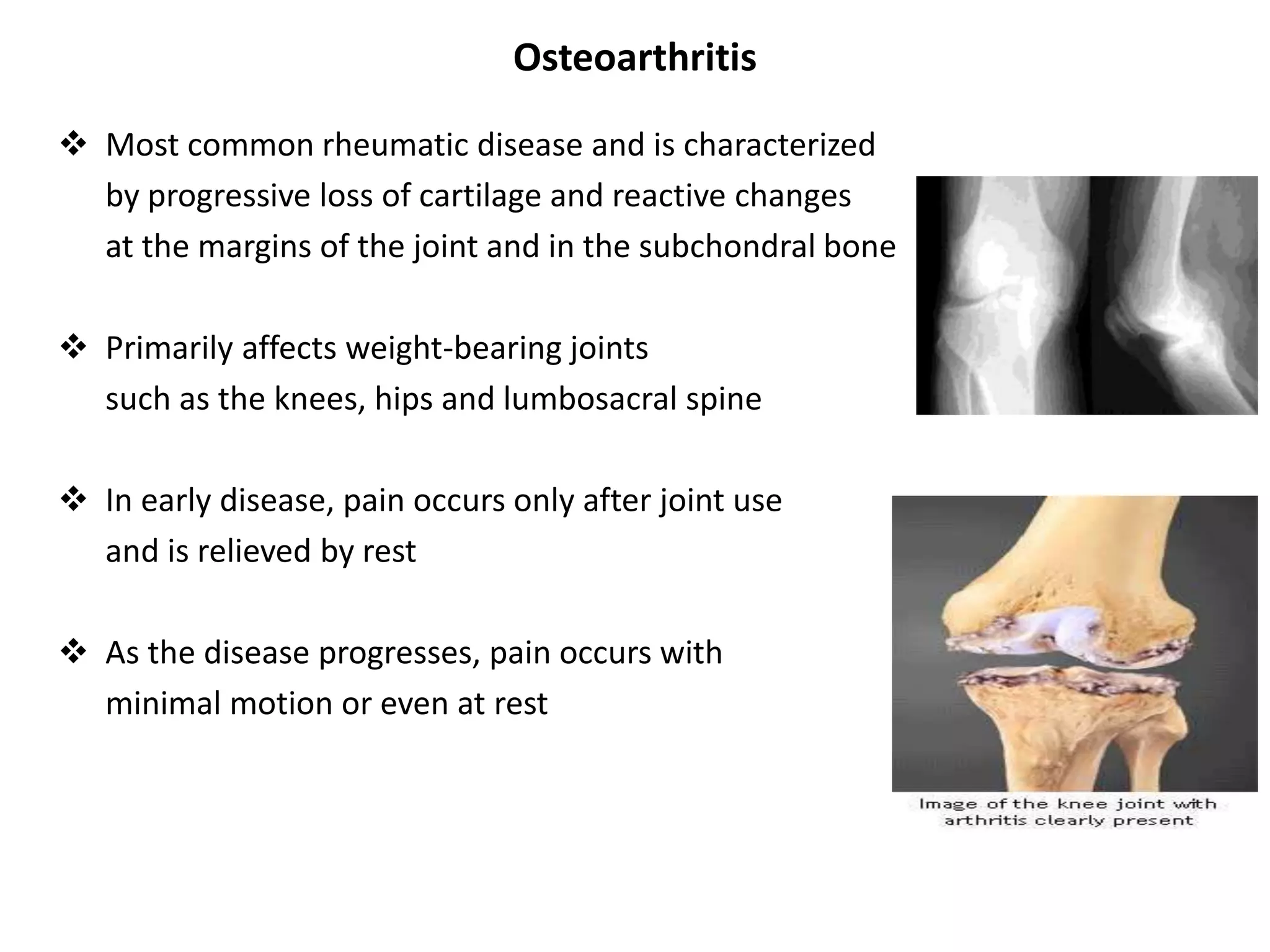 Various rheumatological diseases | PPTX