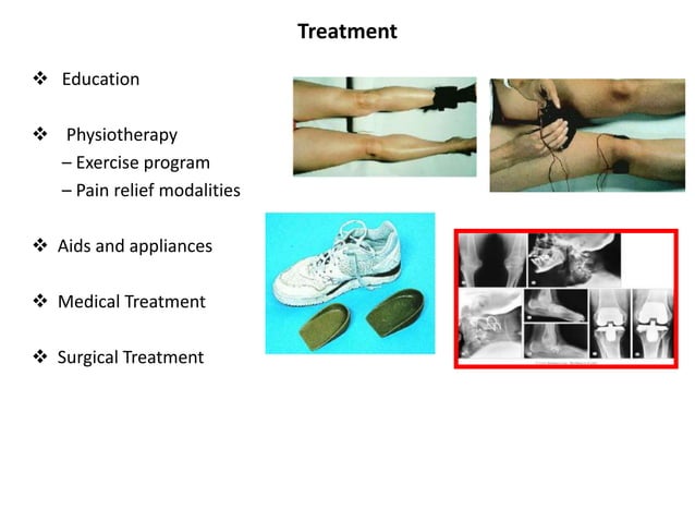 Various rheumatological diseases | PPTX