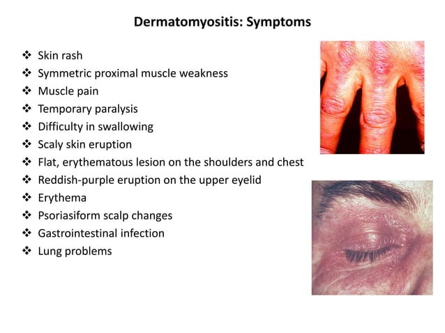 Various rheumatological diseases | PPTX