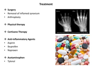 Various rheumatological diseases | PPTX