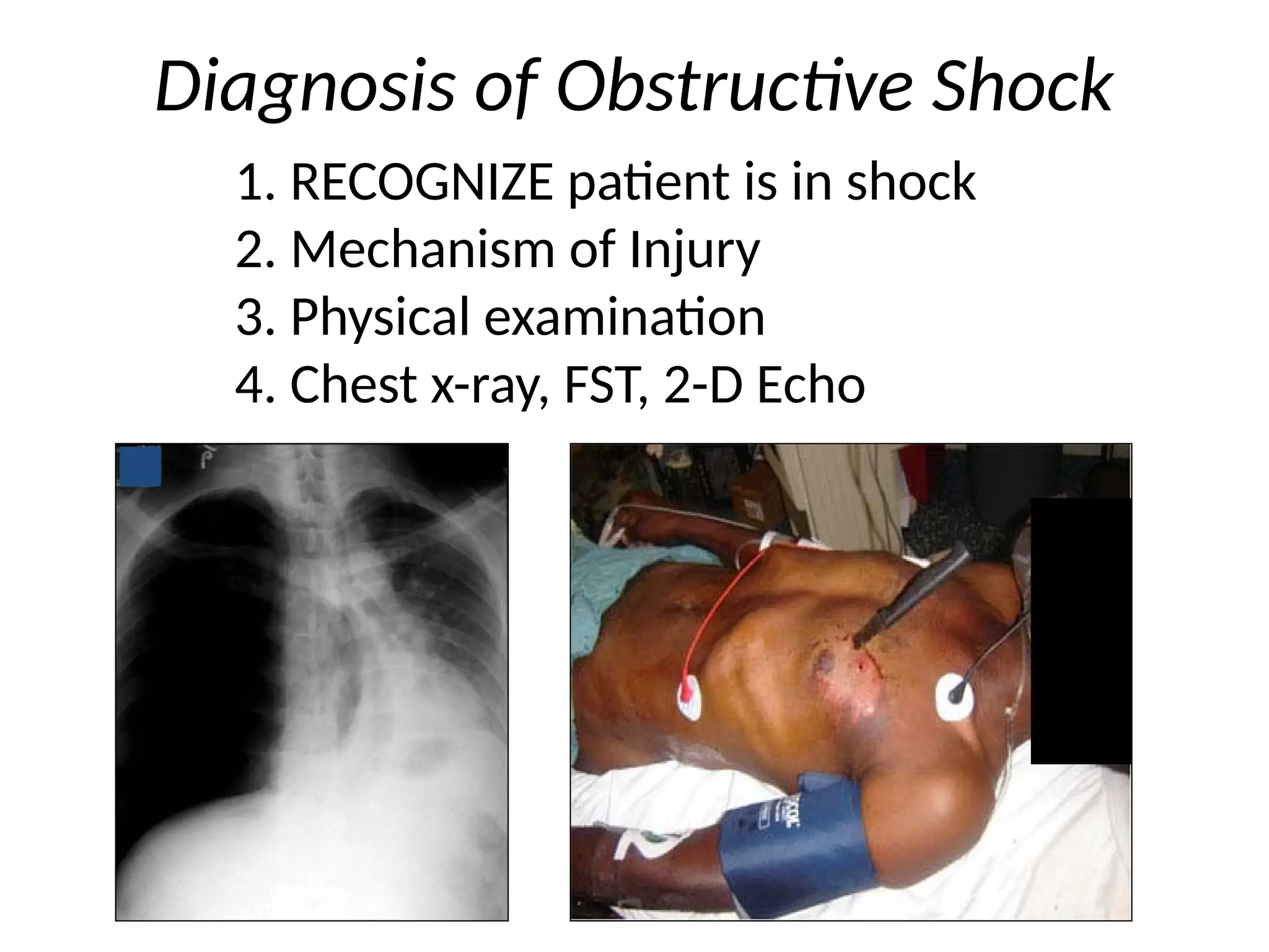 various shock types hemorrhagic and others.pptx