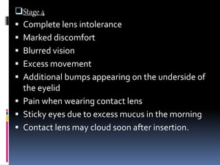 Various stages of contact lens induced papillary conjunctivitis | PPT