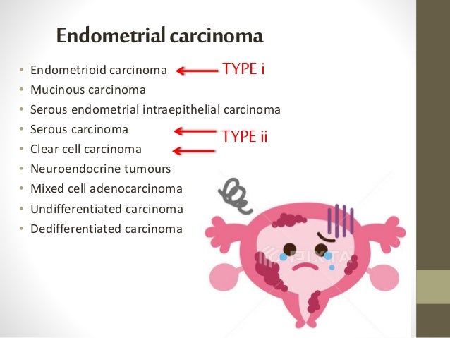 Various types of endometrial carcinoma
