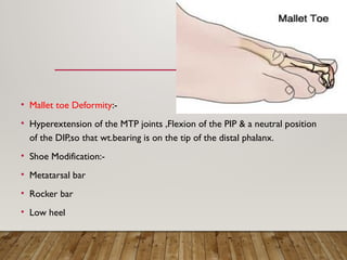 Various Types OF Shoe Modification in orthotics | PPTX