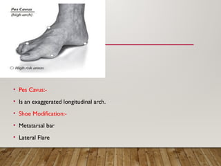 Various Types OF Shoe Modification in orthotics | PPTX