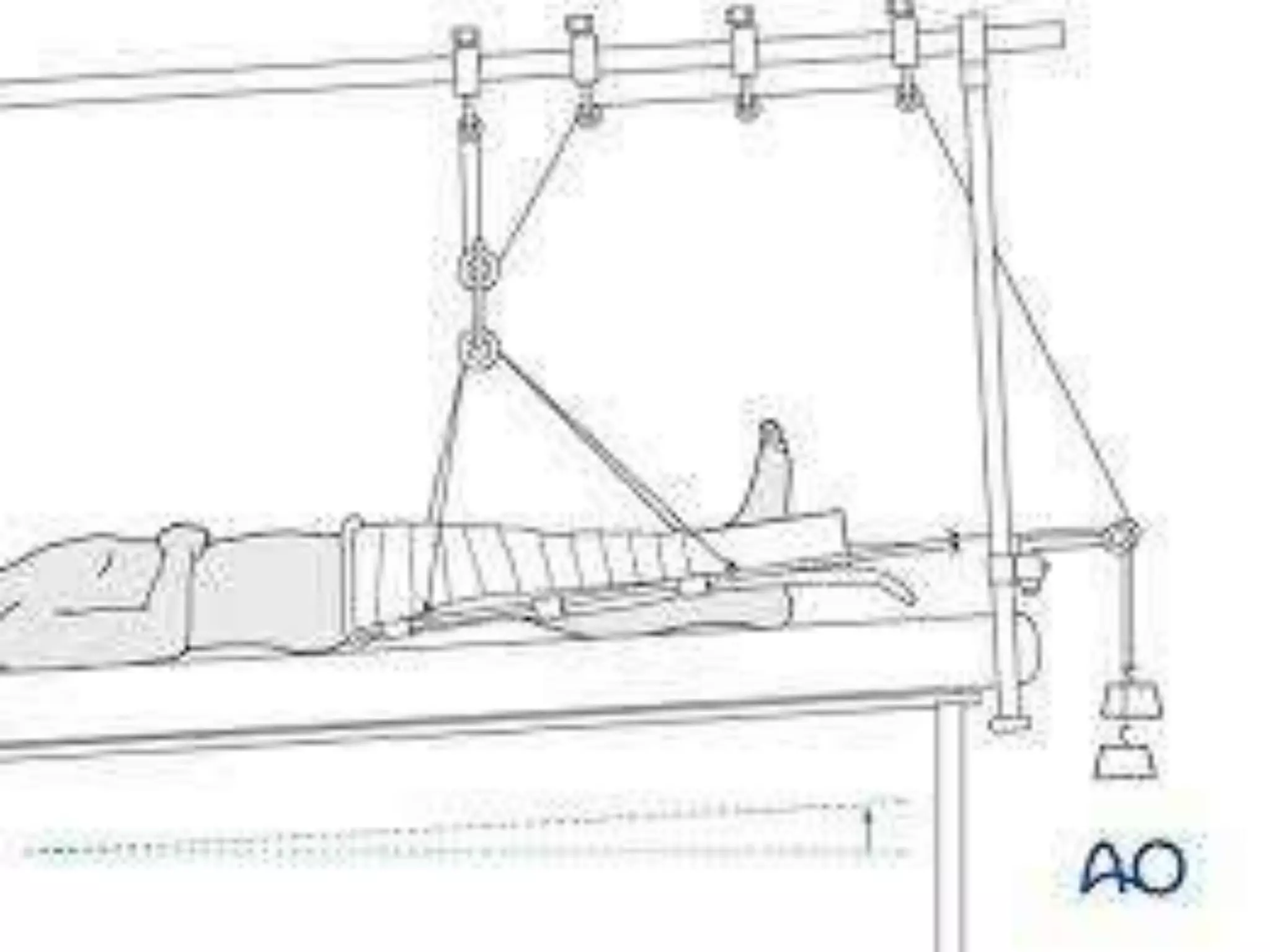 Various types of splints and basics | PPTX