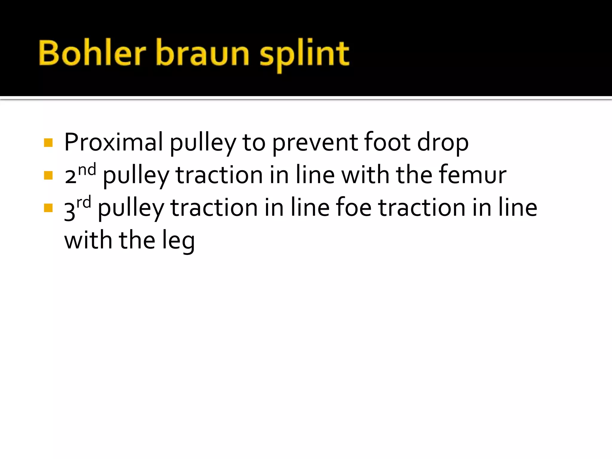 Various types of splints and basics | PPTX