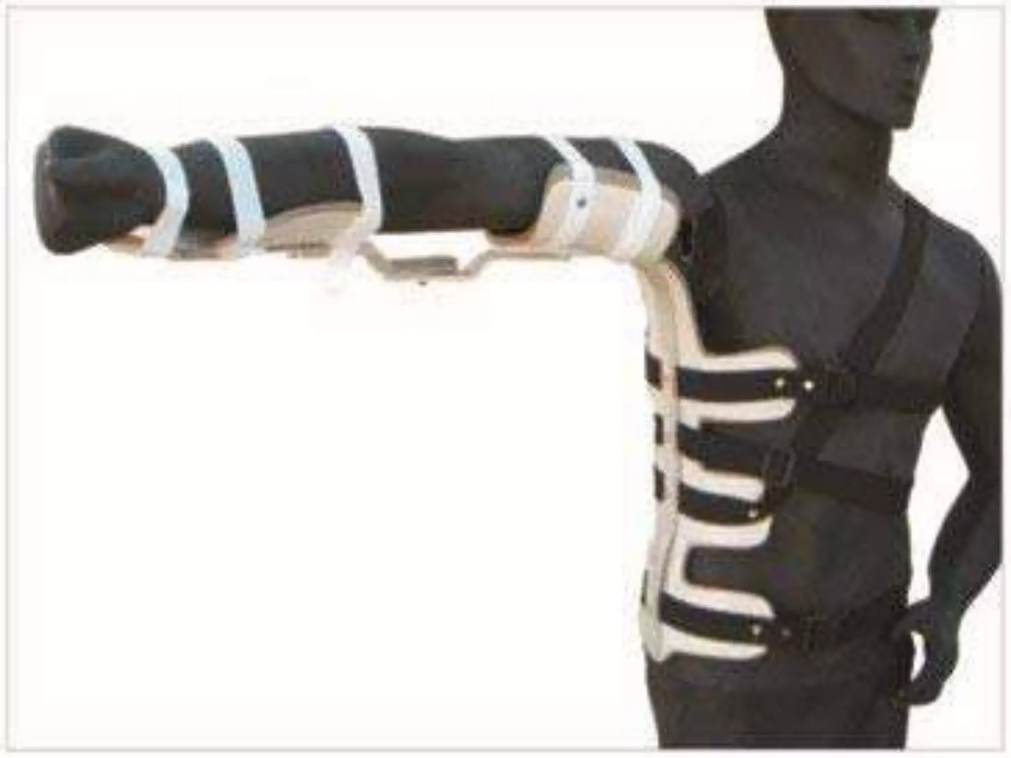 Various types of splints and basics | PPTX