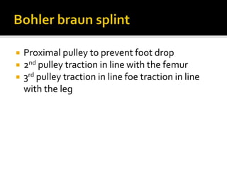 Various types of splints and basics | PPTX
