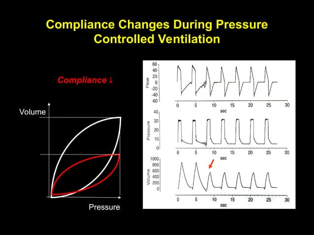 Various ventilator modes for healthcare! | PPT