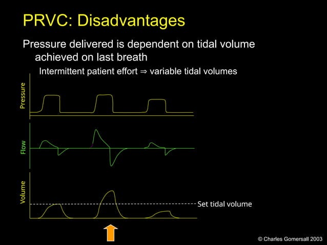 Various ventilator modes for healthcare! | PPT