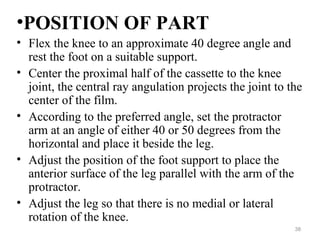 Various X-ray views of Knee Joint | PPT
