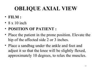 Various X-ray views of Knee Joint | PPT