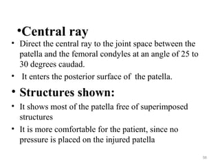 Various X-ray views of Knee Joint | PPT