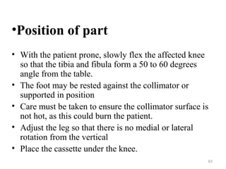Various X-ray views of Knee Joint | PPT