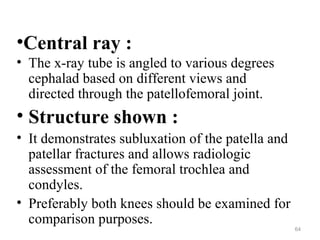 Various X-ray views of Knee Joint | PPT