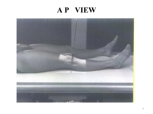 Various X-ray views of Knee Joint | PPT | Death, Injury, or Military ...