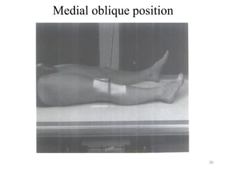 Radiographic Positioning Of The Knee