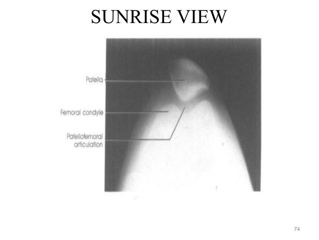 Various X-ray views of Knee Joint