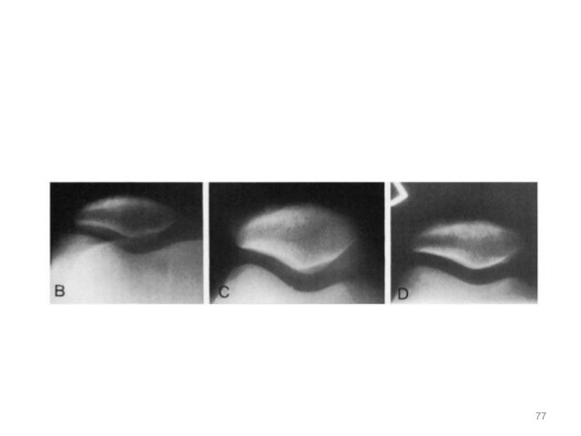 Various X-ray views of Knee Joint
