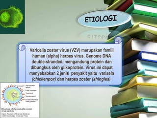 contoh kasus laporan kasus penyakit varisela | PPT