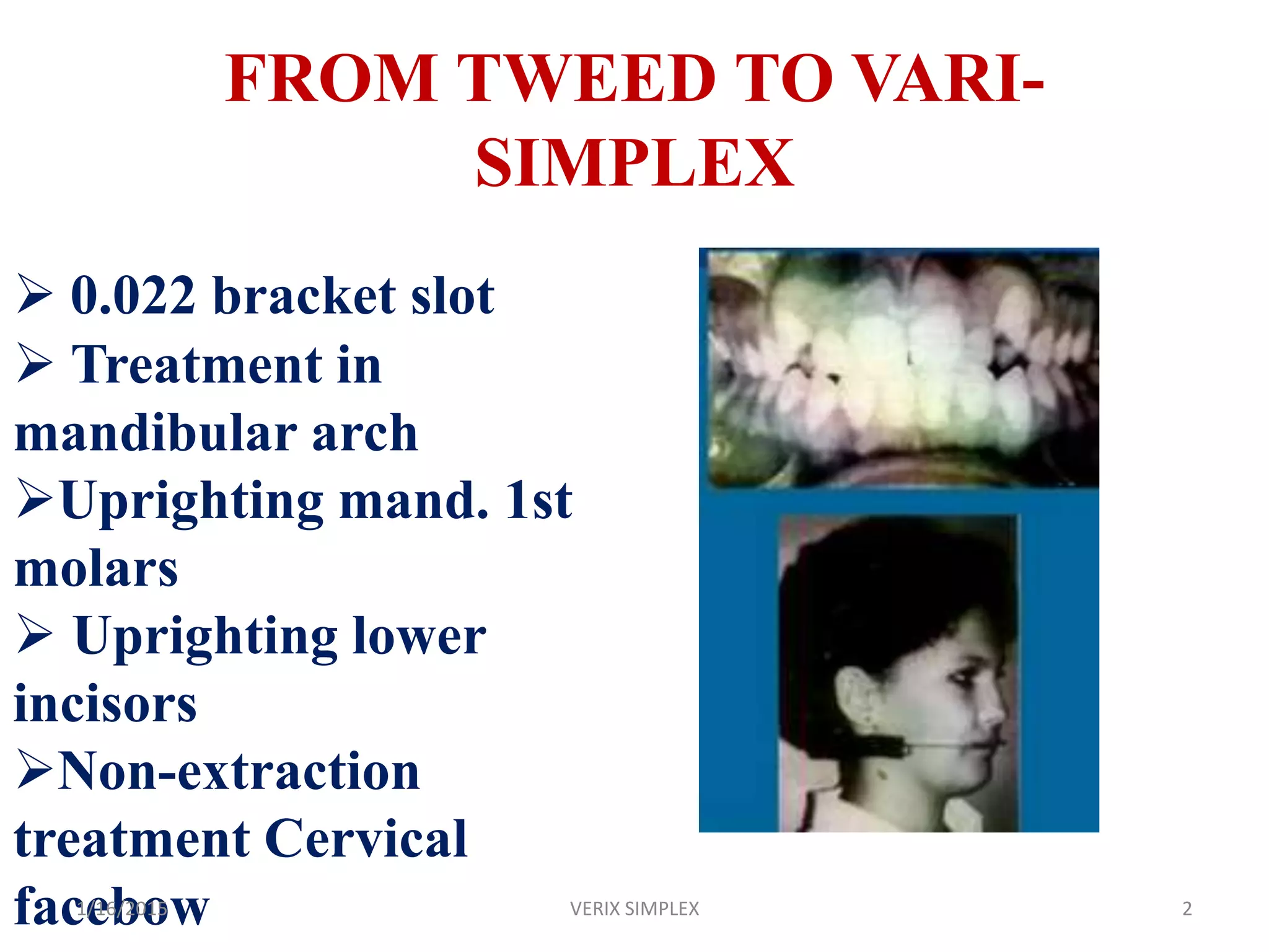 Varix simplex | PPTX