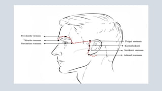 VARMAM Standard of procedure for the varmam related to head | PPTX